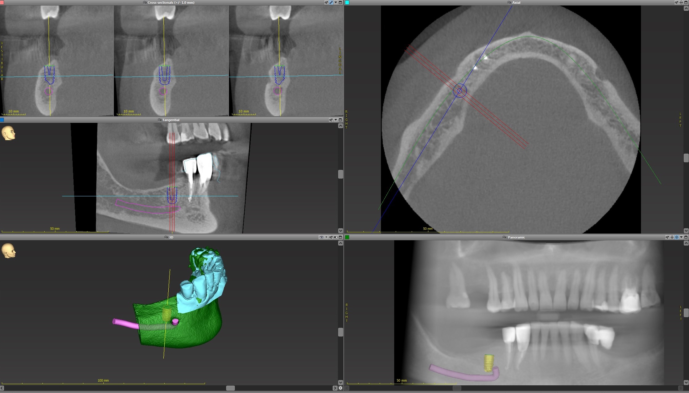 CBCT - röntgen | My Dental Guide